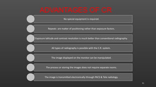 7. ADVANCEMENTS IN IMAGE RECEPTORS AND DIGITAL RADIOGRAPHY by Ravindra ...