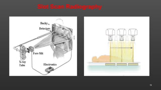 7. ADVANCEMENTS IN IMAGE RECEPTORS AND DIGITAL RADIOGRAPHY by Ravindra ...