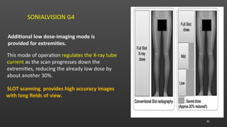7. ADVANCEMENTS IN IMAGE RECEPTORS AND DIGITAL RADIOGRAPHY by Ravindra ...