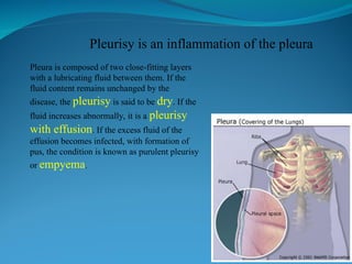 6.1 Pleurisy vgfvvgvgvgvgvgvbbjbbbb.ppt