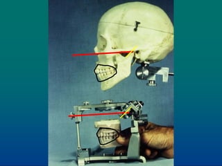 6. facebow and articulators preclinic.pptx