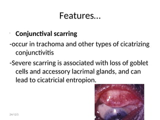 6. conjunctival disease nd trachoma.ppts