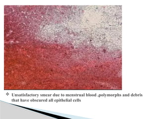 6. Criteria of satisfactiory and unsatisfactory.pptx