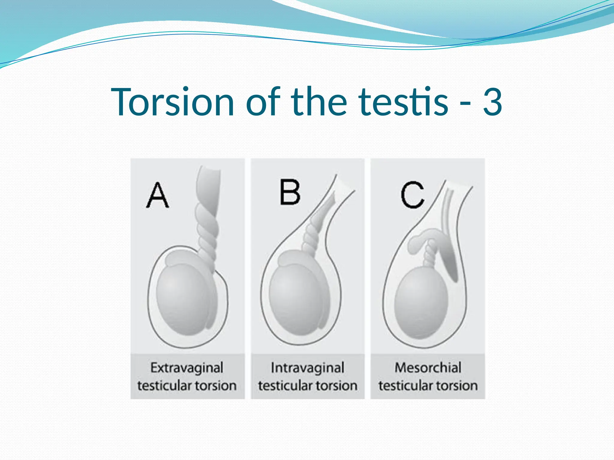 6. Congenital genitourinary Disorders 4.pptx