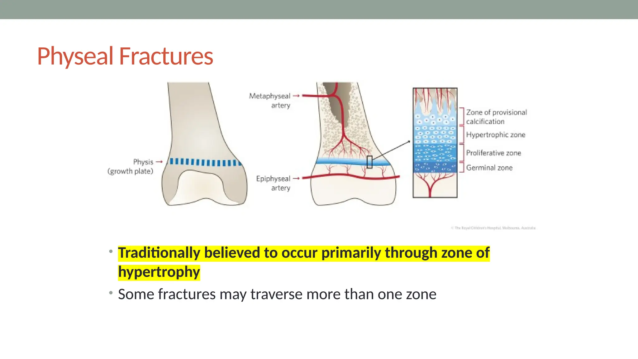 6.Pediatric Fractures................pptx
