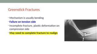 6.Pediatric Fractures................pptx