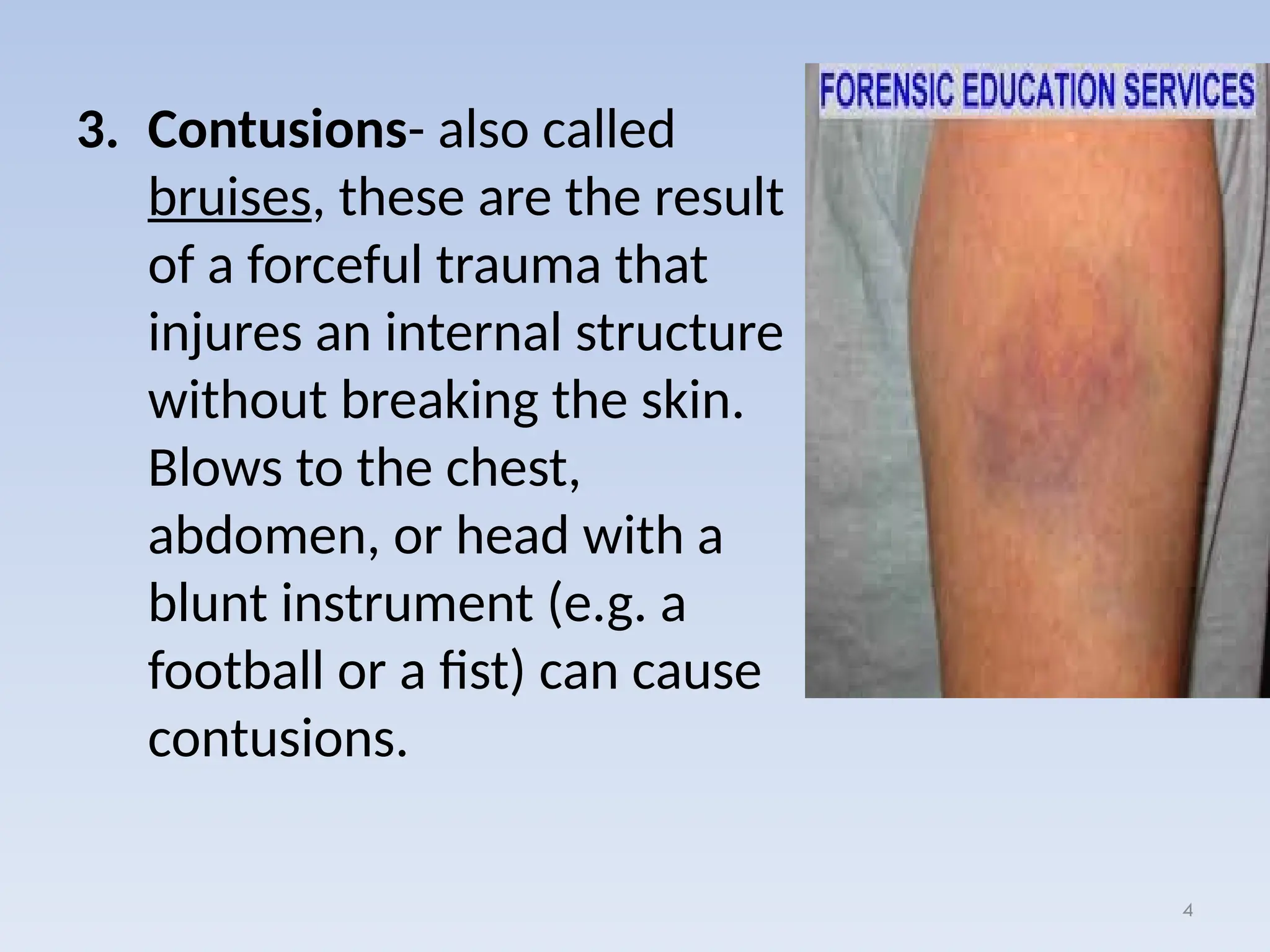 6. Soft Tissue Injury (2024-2025) (1).pptx