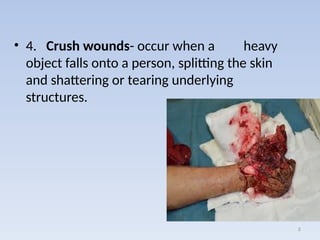 6. Soft Tissue Injury (2024-2025) (1).pptx