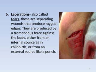 6. Soft Tissue Injury (2024-2025) (1).pptx