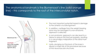 RETROGRADE DISTAL FEMUR NAILING-Dr.Manikandan.pptx