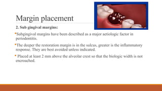 6. finish lines in fixed partial denture | PPTX