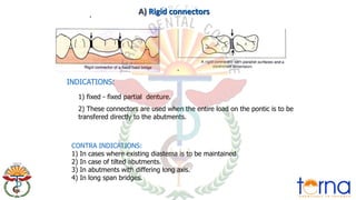 6.-connectors-for-fixed partial denture fpd.pdf