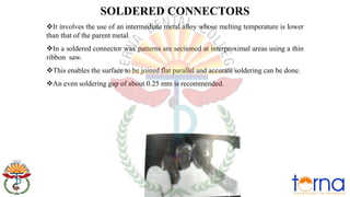 6.-connectors-for-fixed partial denture fpd.pdf