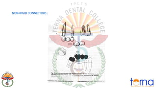6.-connectors-for-fixed partial denture fpd.pdf