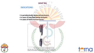 6.-connectors-for-fixed partial denture fpd.pdf