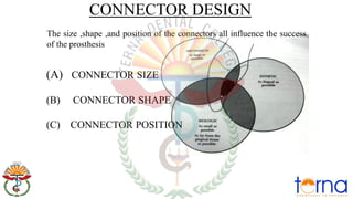 6.-connectors-for-fixed partial denture fpd.pdf