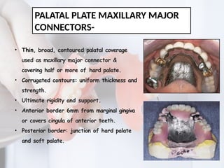 MAJOR CONNECTORS IN REMOVABLE PARTIAL DENTURE | PPTX