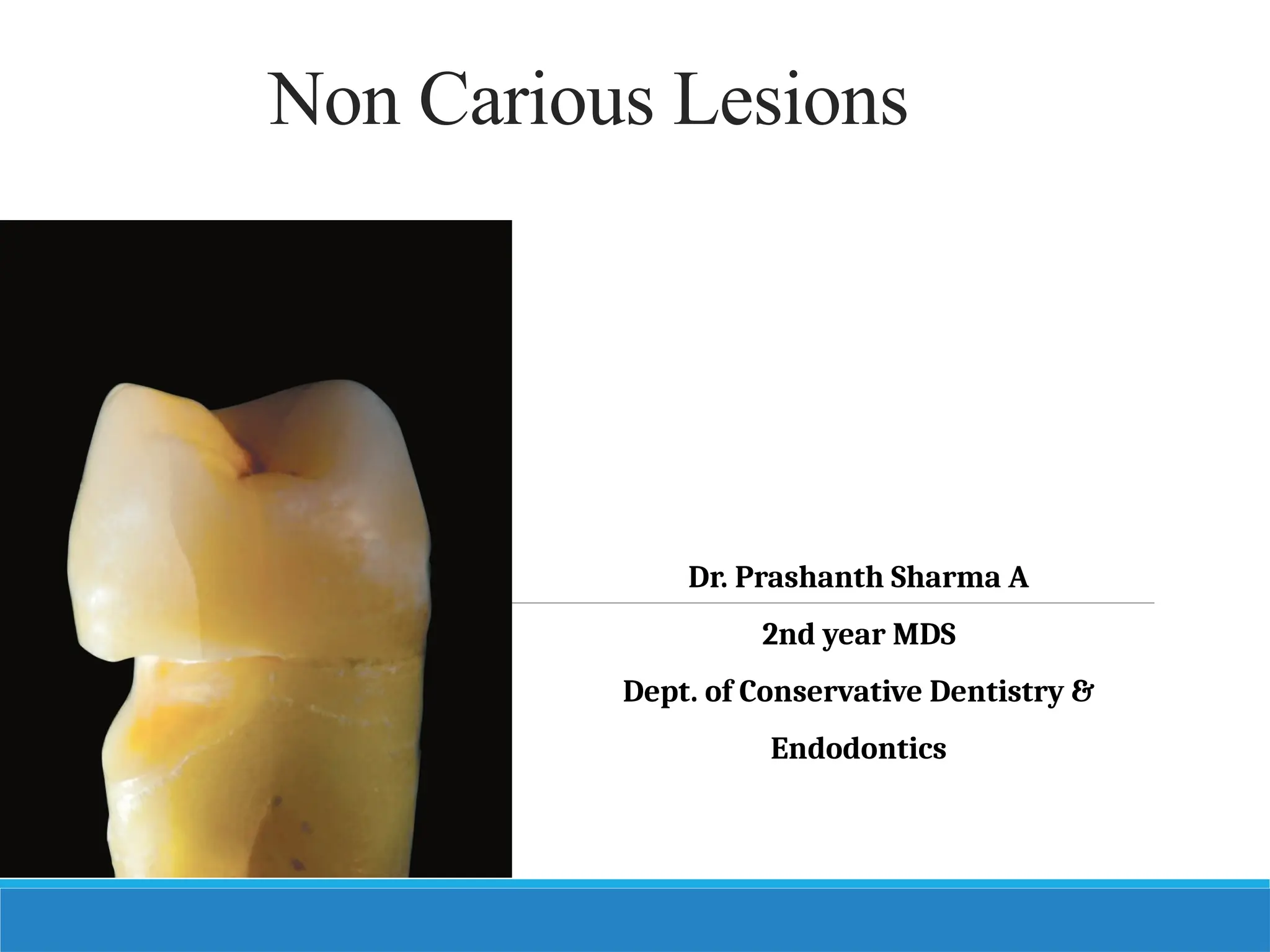 Non carious lesions of teeth and their management.pptx