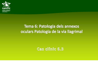 6. 3 obstrucció llag dacriocistitis 1 | PPT