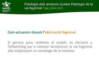 6. 3 obstrucció llag dacriocistitis 1 | PPT