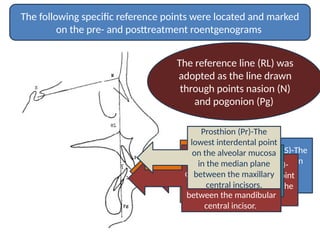 6-6- 24 soft tissue retraction ORTHODONTICS.pptx