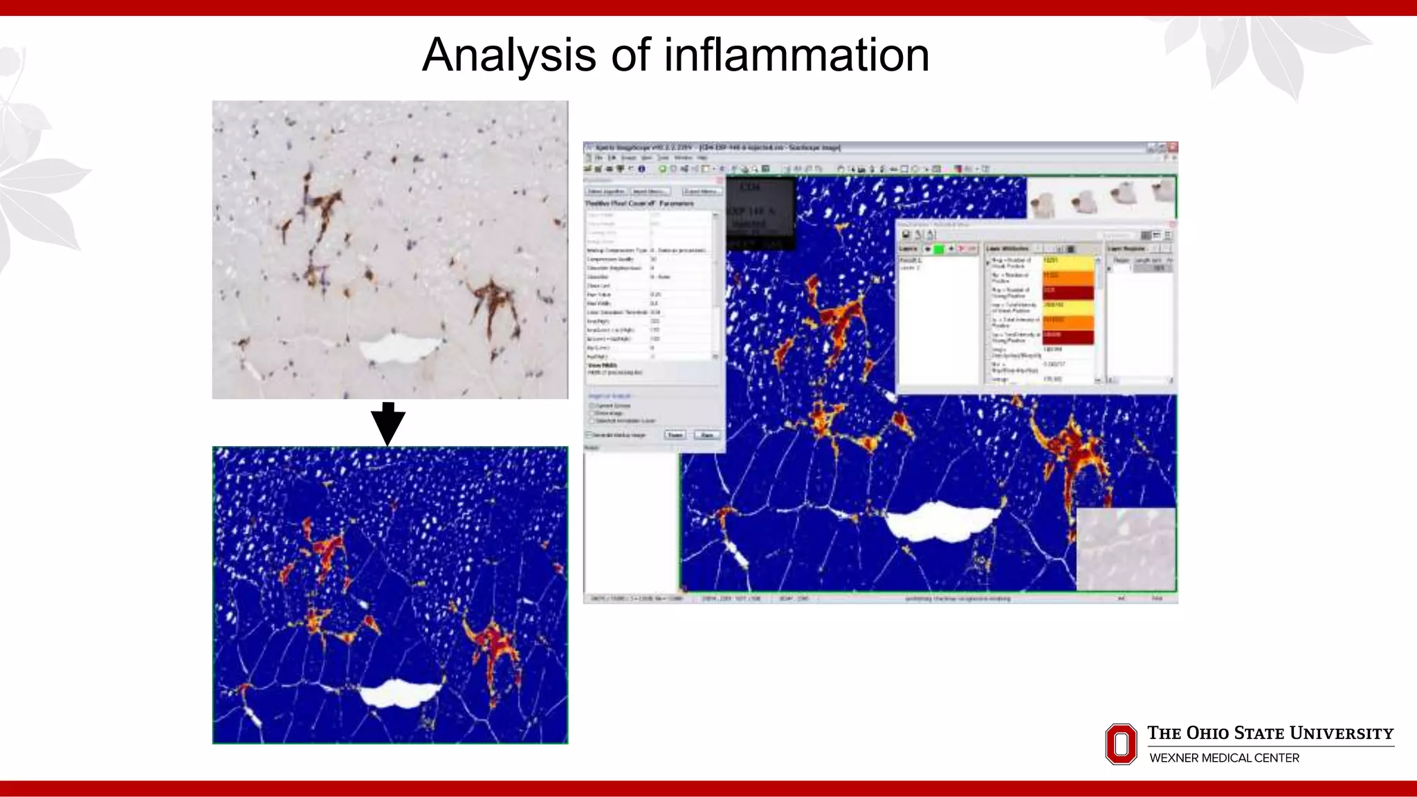 “A Chimeric Human-Mouse Model of Sjögren's Syndrome” | PPTX