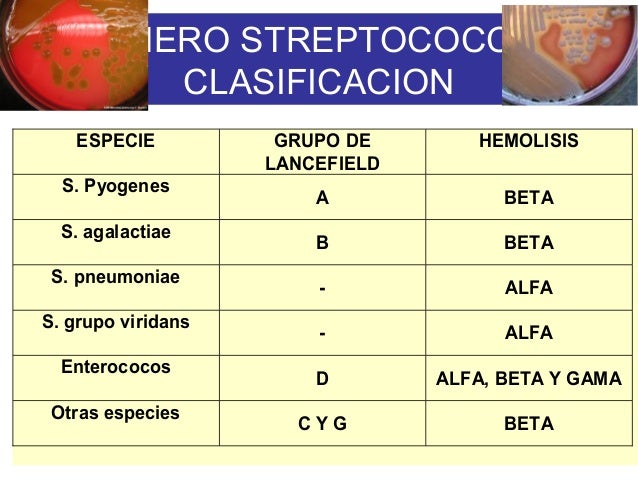 streptococcus microbiologia