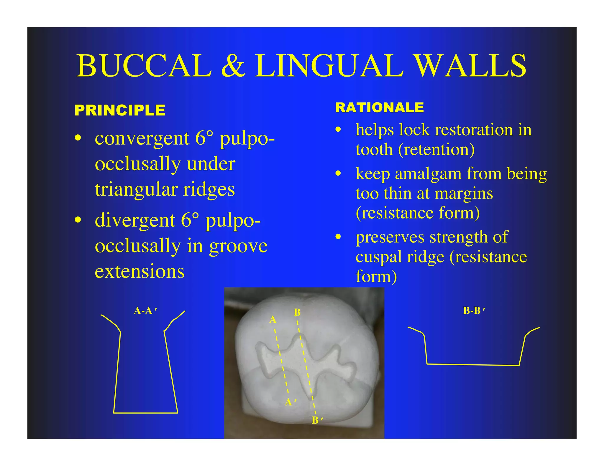 principles of tooth preparation (class one) | PDF