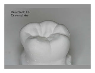 principles of tooth preparation (class one) | PDF