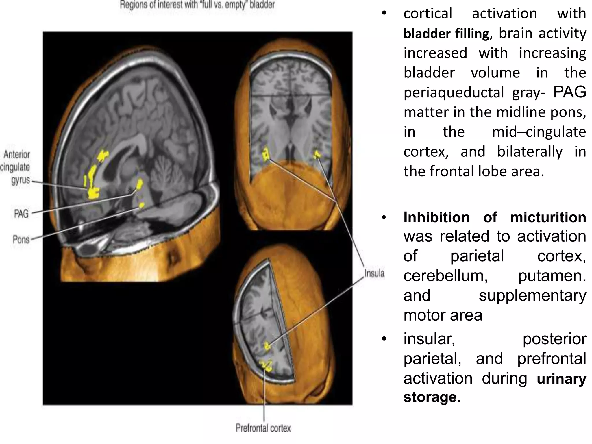 Bladder disorders(neurogenic) | PPTX