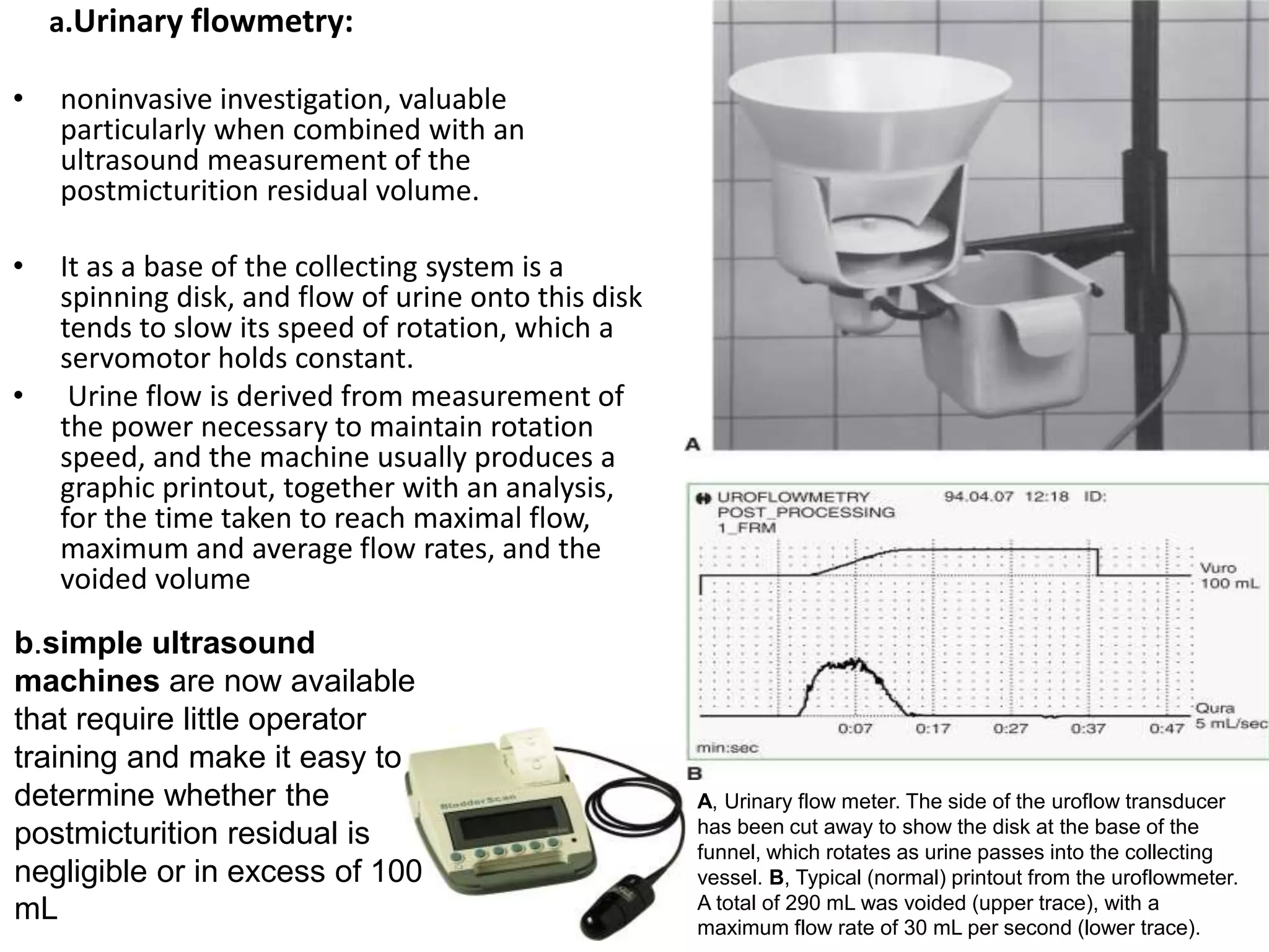 Bladder disorders(neurogenic) | PPTX