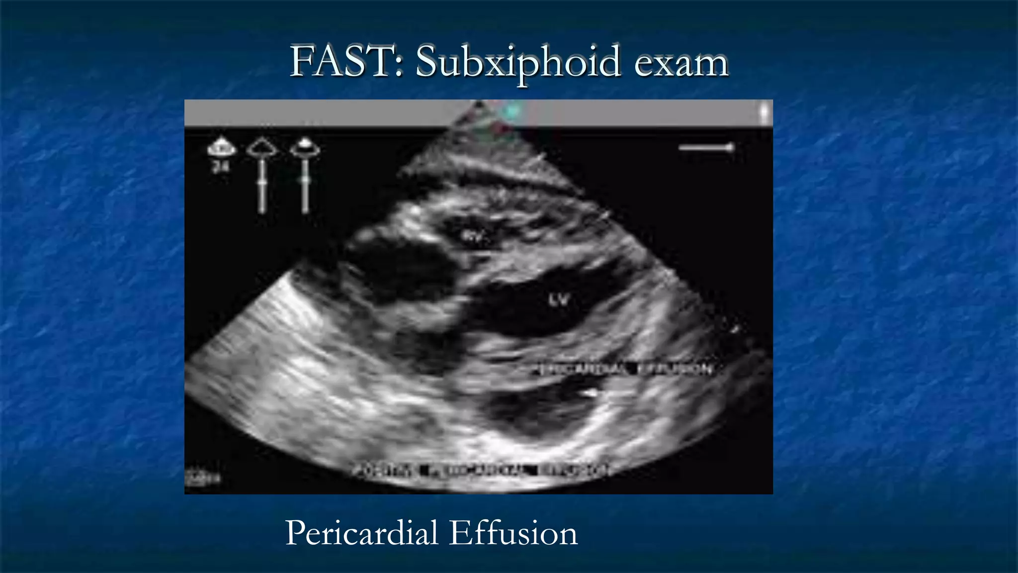6- Abdominal Trauma and FAST Scan.pptx