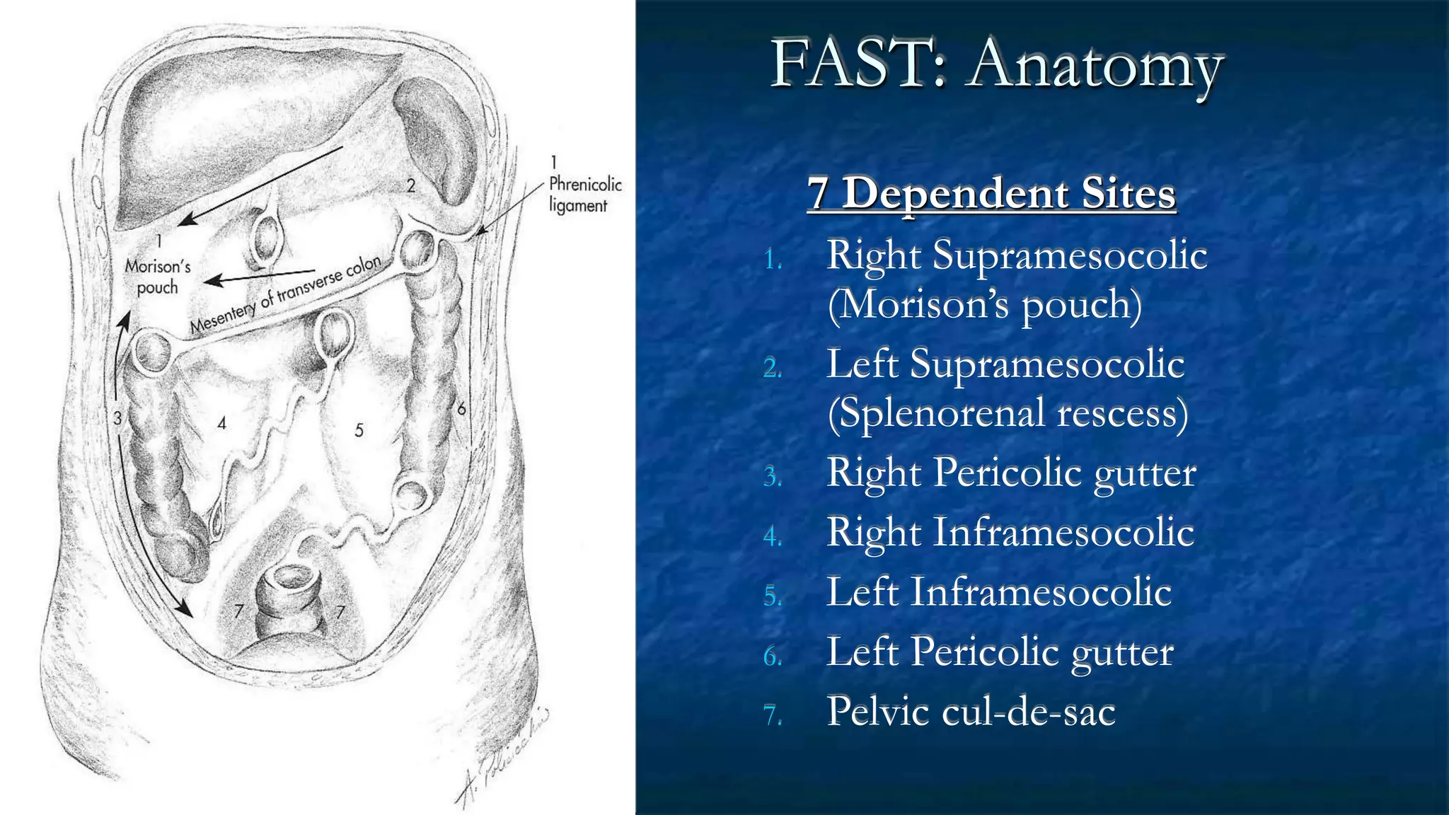 6- Abdominal Trauma and FAST Scan.pptx