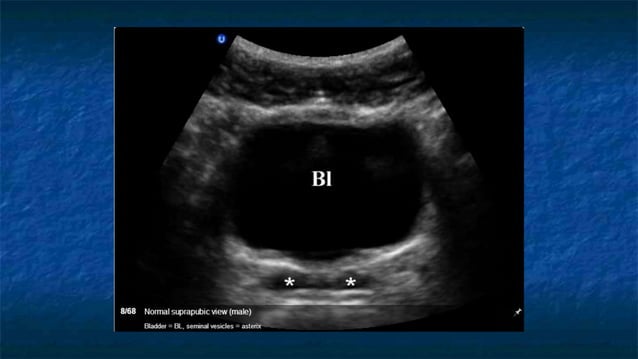 6- Abdominal Trauma and FAST Scan.pptx