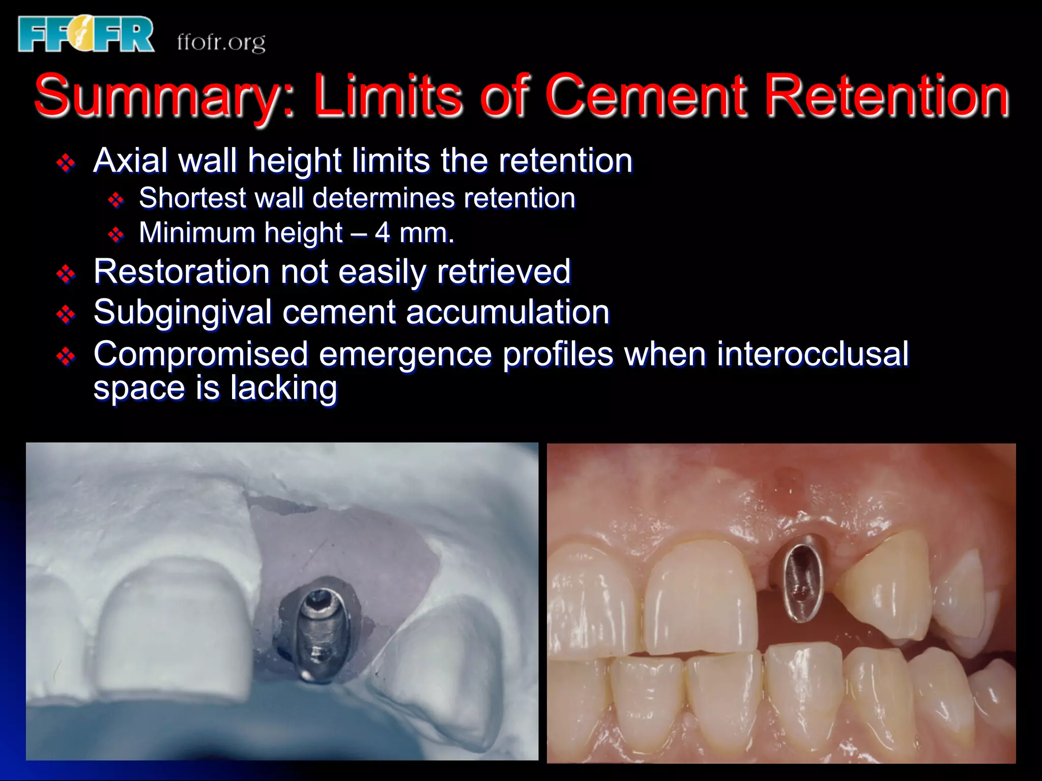 Abutment Selection | PDF | Dental Health | Diseases and Conditions