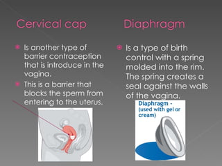 6 anticonception | PPT | Birth Control | Reproductive Health