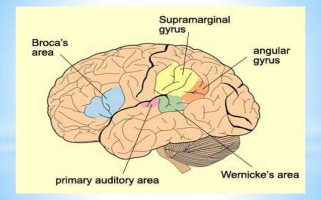 Aphasia | PPTX | Brain and Nervous System Disorders | Diseases and ...