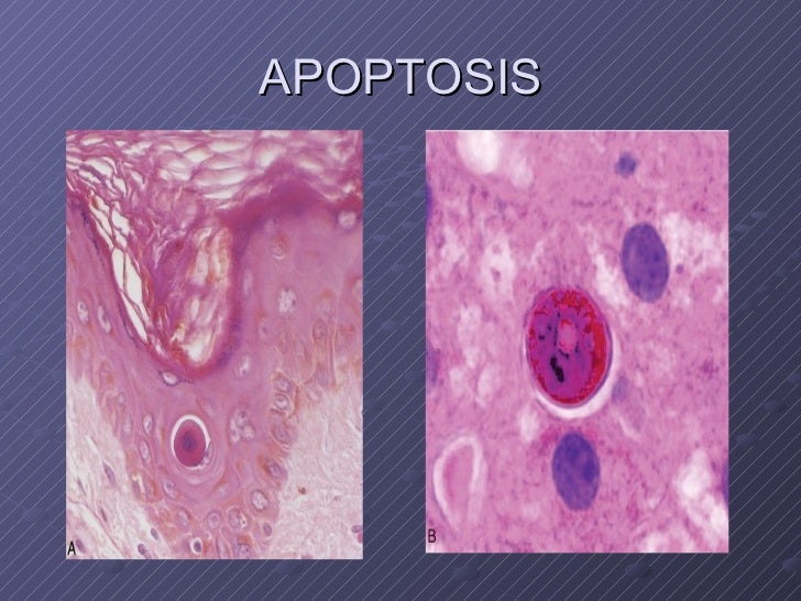 Apoptosis