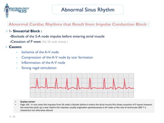Cardiac Arrhythmias complete detailed lecture .pdf