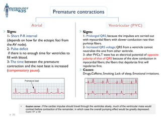 Cardiac Arrhythmias complete detailed lecture .pdf