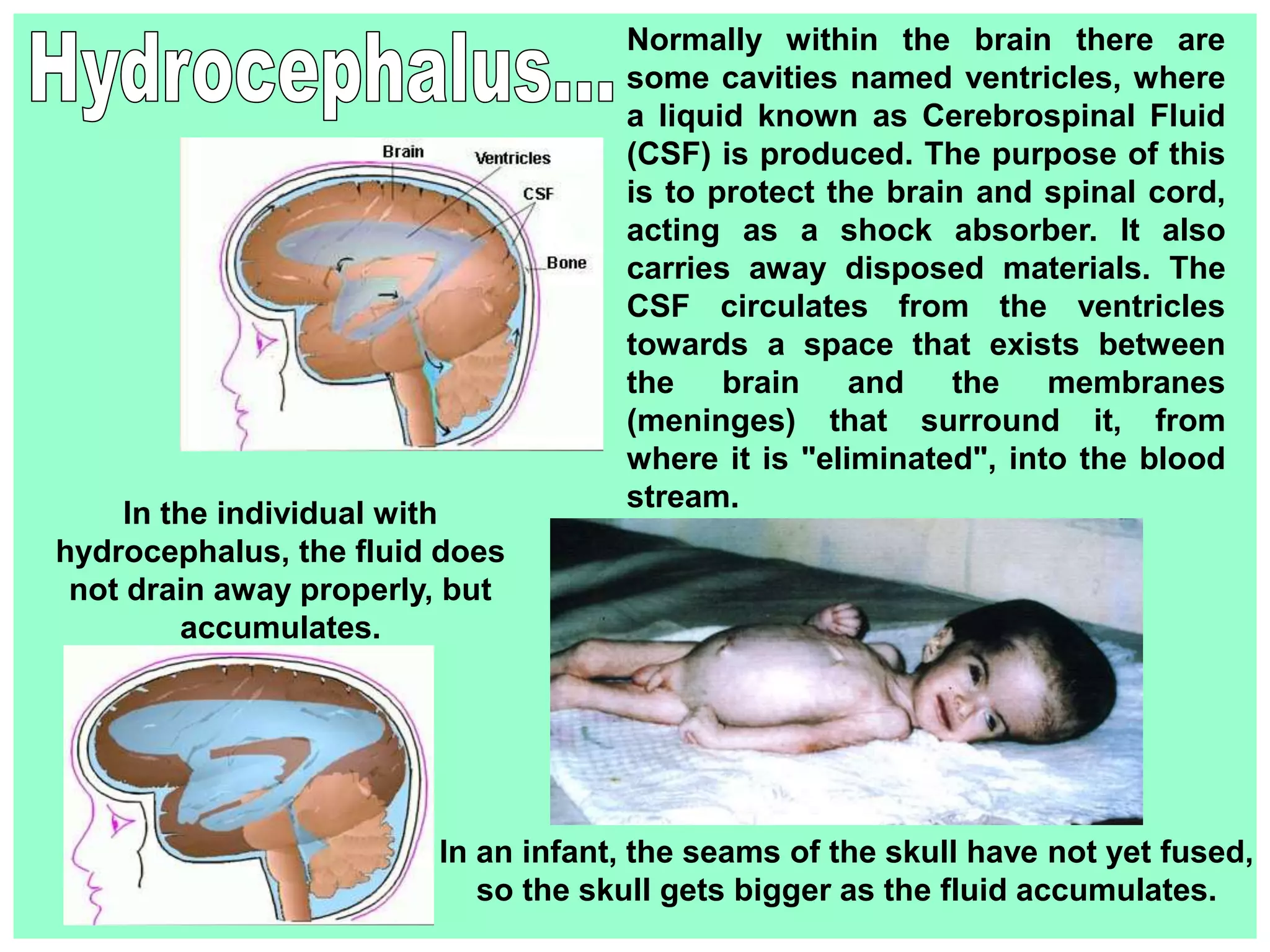 6-Birth-Defects.ppt