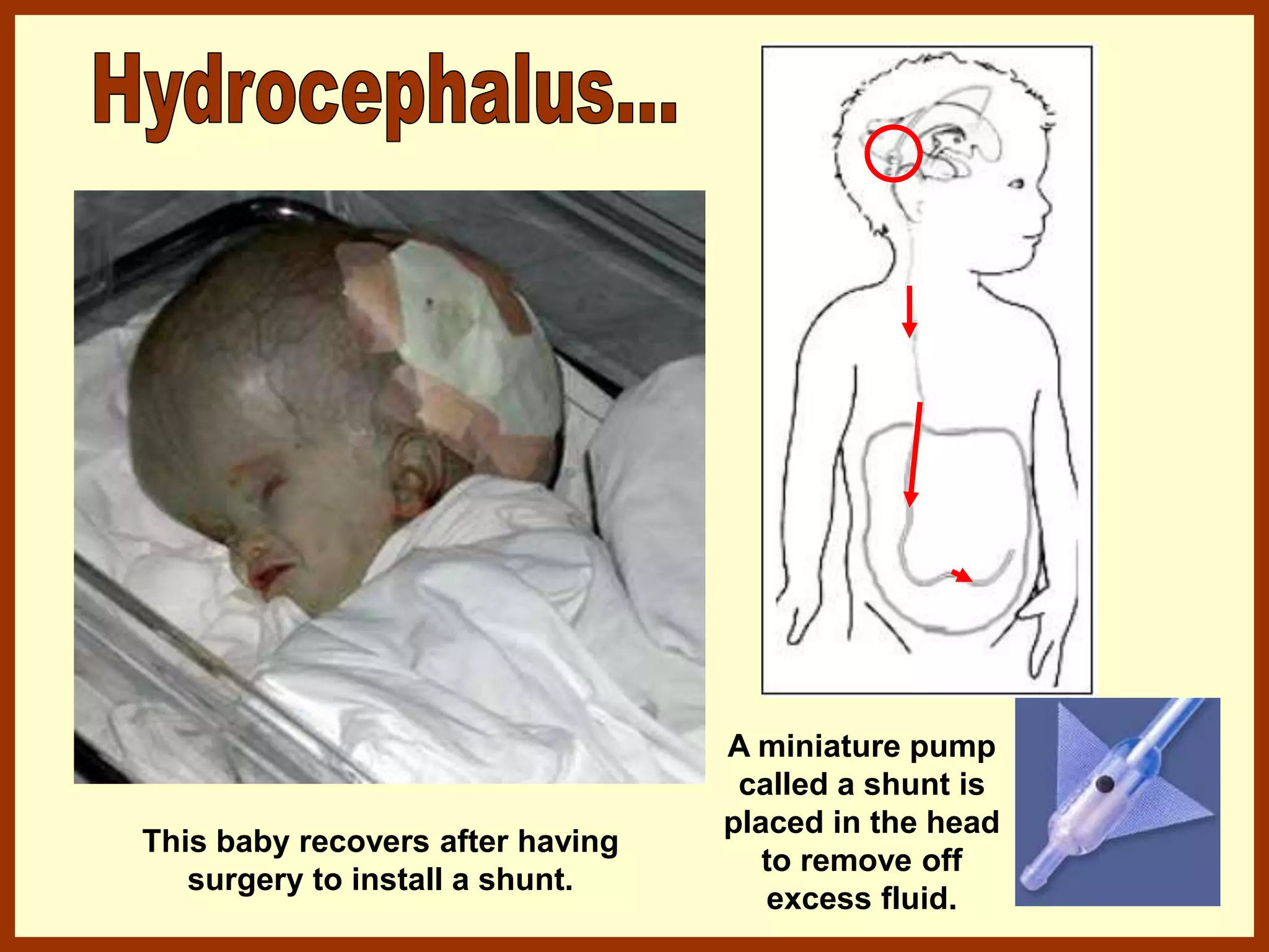 6-Birth-Defects.ppt