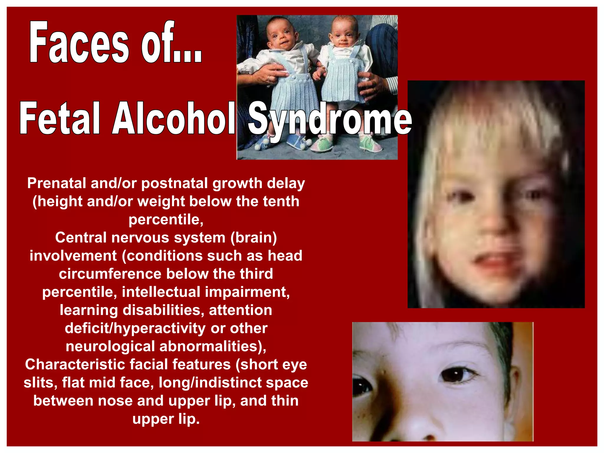 6-Birth-Defects.ppt