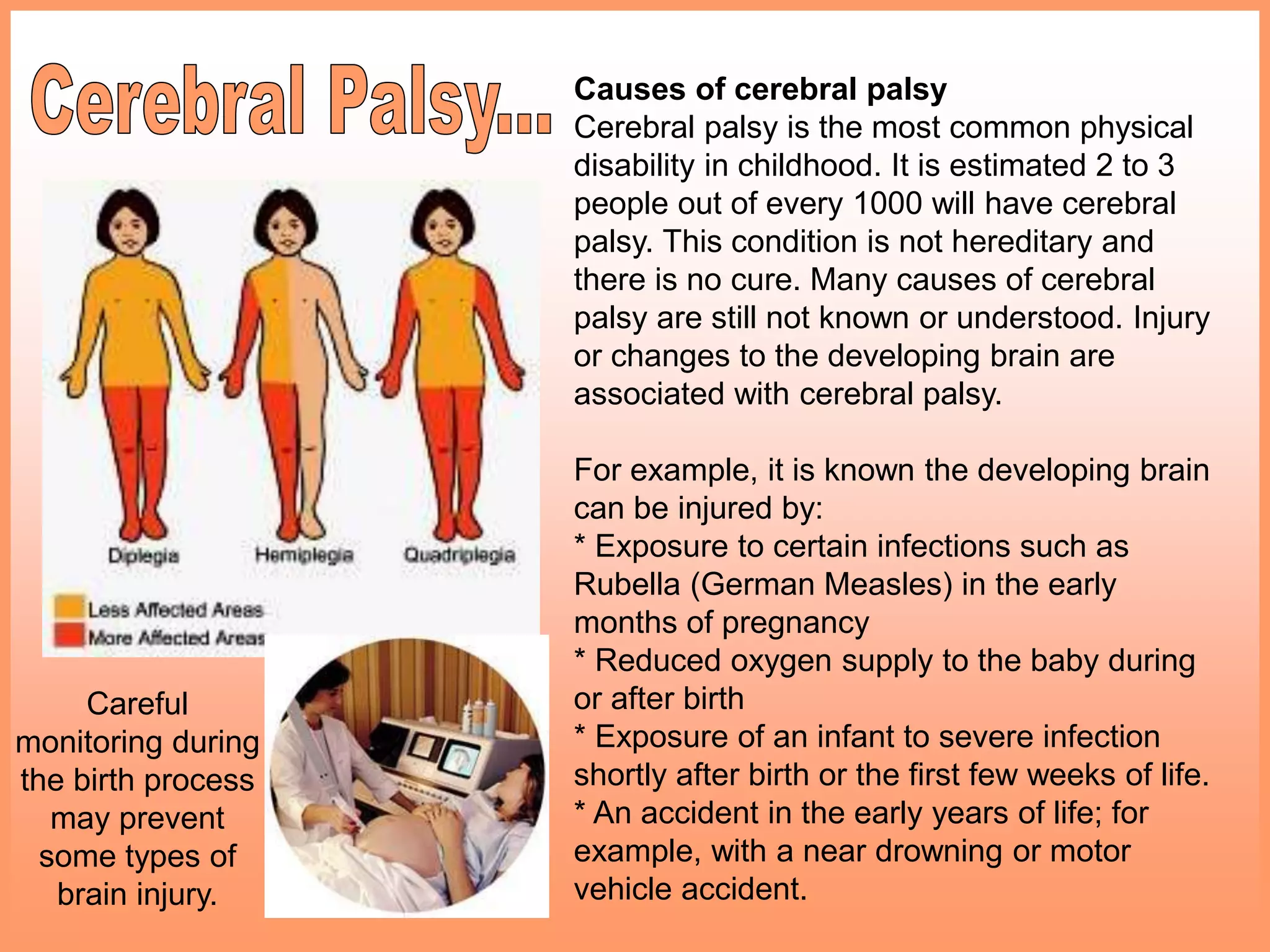 6-Birth-Defects.ppt