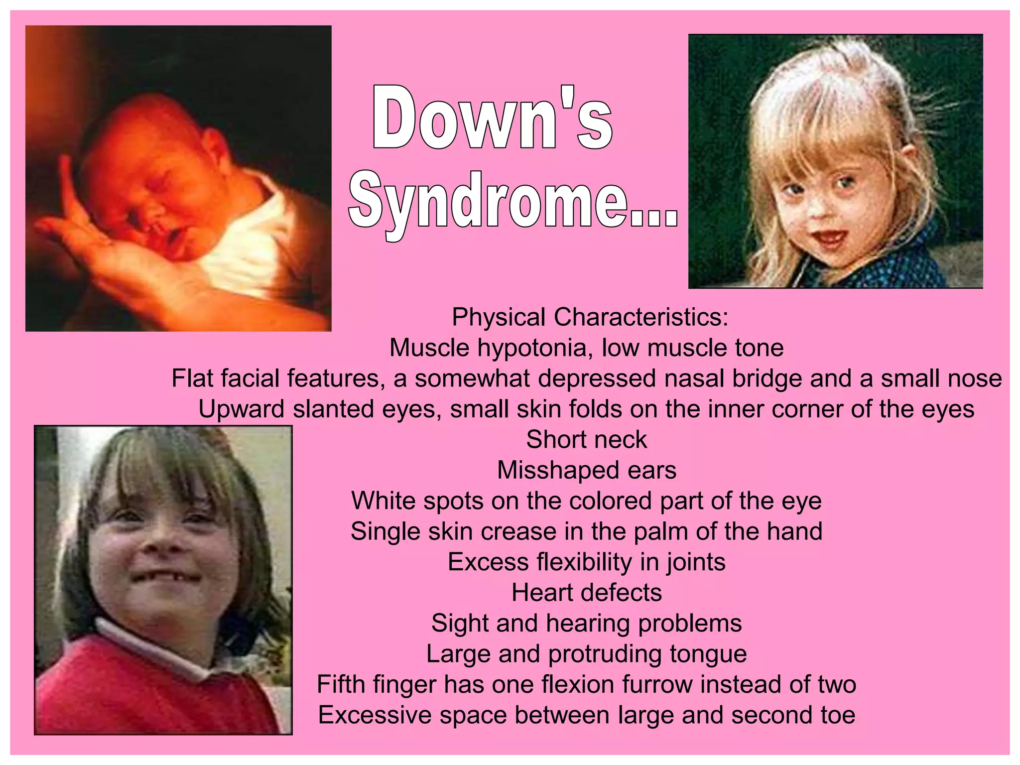 6-Birth-Defects.ppt