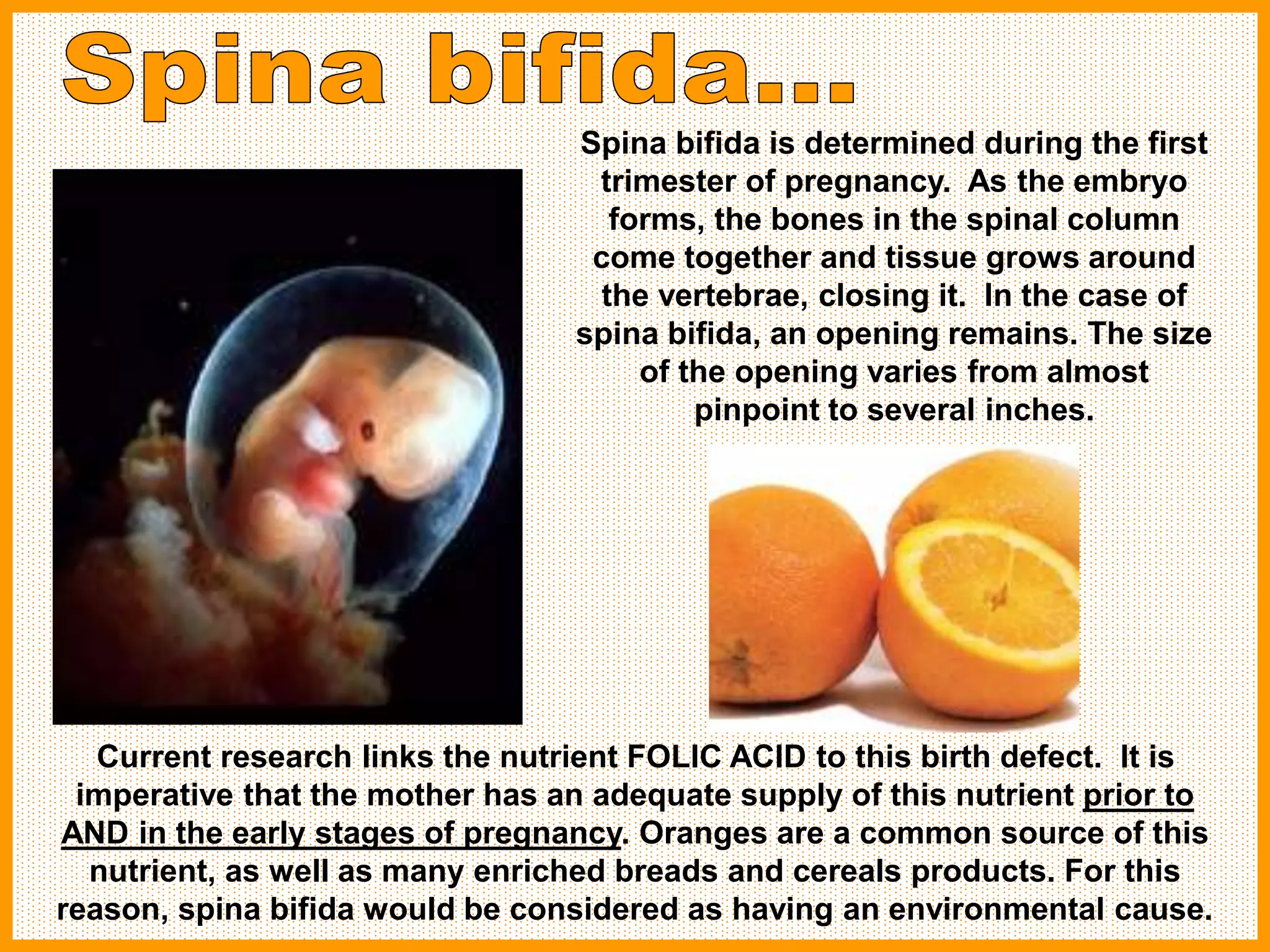 6-Birth-Defects.ppt