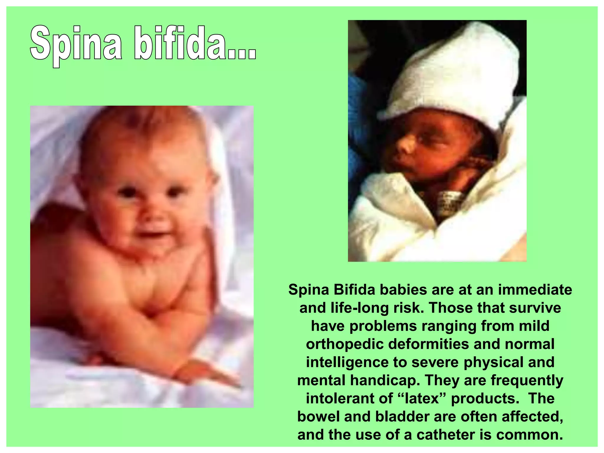 6-Birth-Defects.ppt