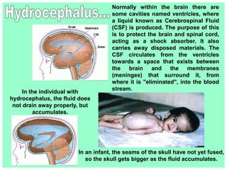 6-Birth-Defects.ppt