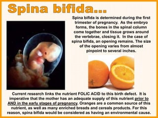 6-Birth-Defects.ppt