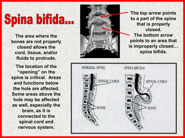 6-Birth-Defects.ppt
